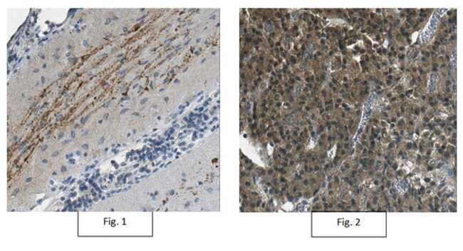 MilliporeSigma Mouse anti-Neurophysin 2/NP-AVP, Clone: PS 45, 100μg ...